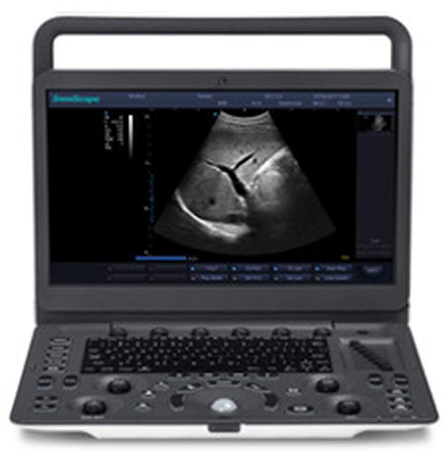 Xcelsitas | SonoScape E1 black white HCU ultrasound device - Smart ...